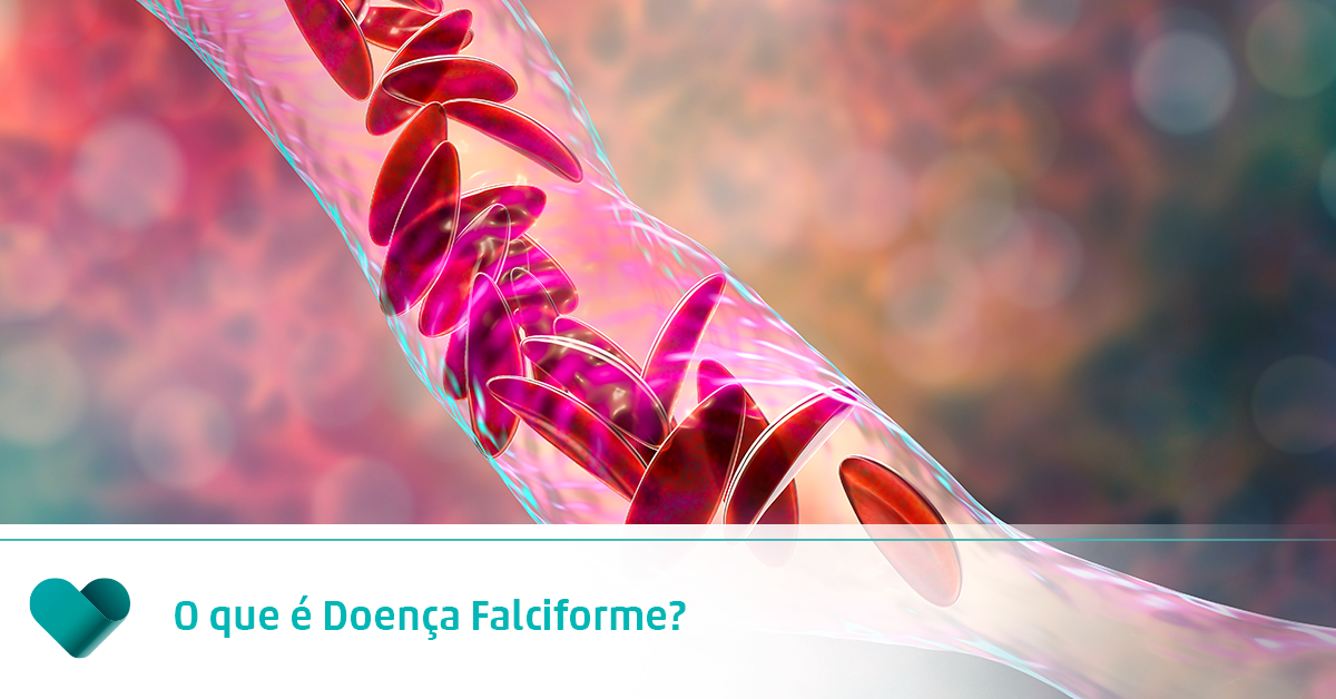 O que é Doença Falciforme? - Blog VidaClass